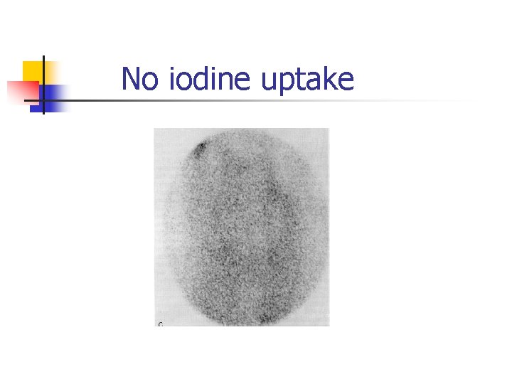 Thyroid Disease Dr Andrew S Bates Heart of