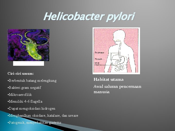 BAKTERI SALURAN CERNA DAN SALURAN NAFAS Bakteri Patogen