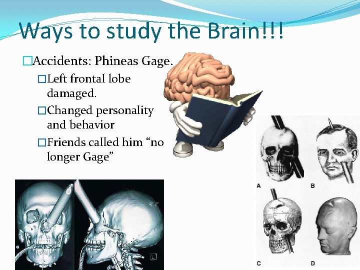 The Brain Made up of neurons and glial