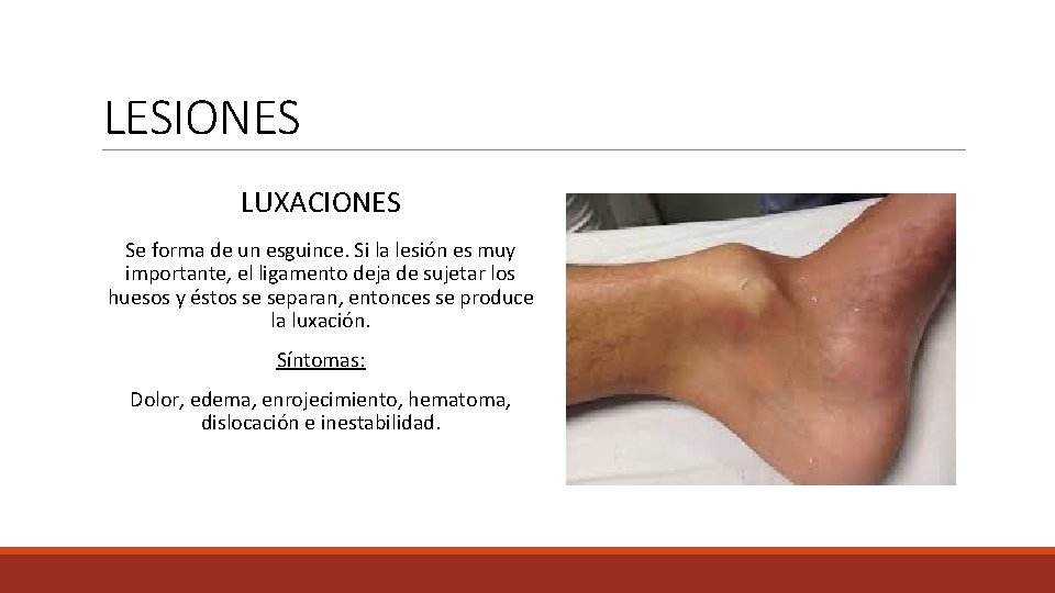 FRACTURAS ESGUINCES Y LUXACIONES Las lesiones en los
