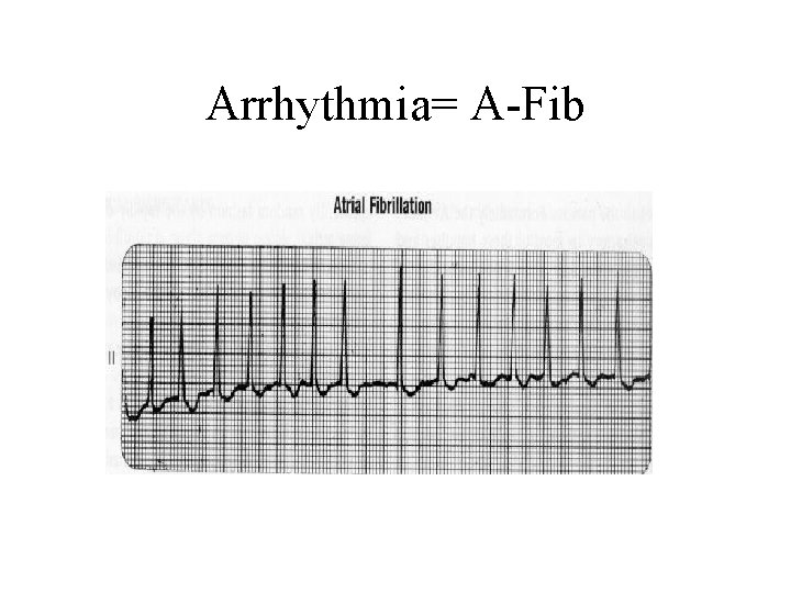 Metabolic Abnormalities Surgical Fundamentals Lecture Asha Bale MD