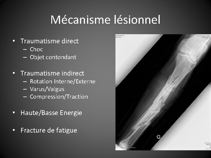 Gnralits Mdicochirurgicales en Orthopdie et Traumatologie Richard Ballas