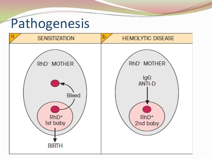 Rh Alloimmunization By M AbdelRahman Nomenclature Exposure to