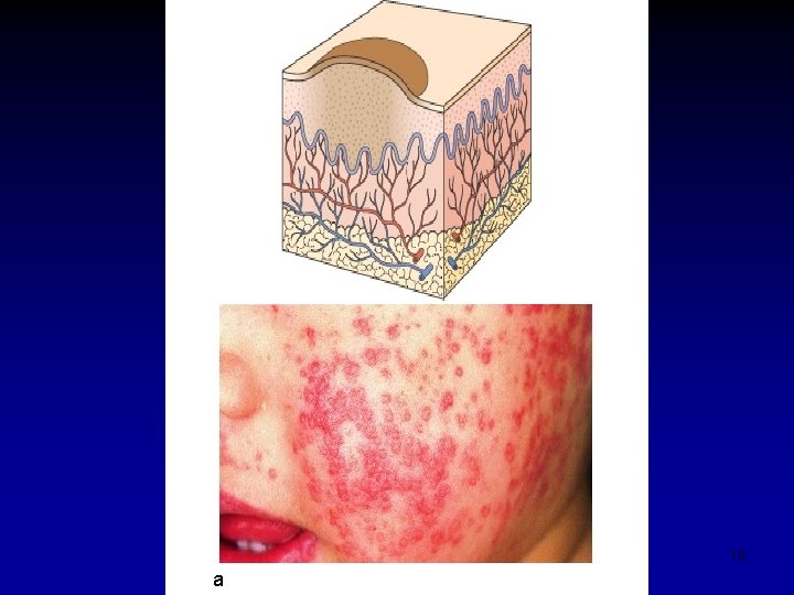 Dermatology Skin hair nails and mucous membranes mouth