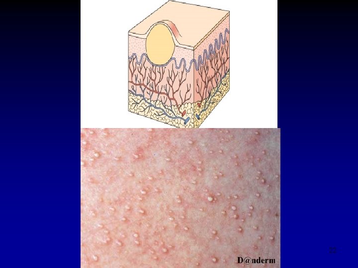 Dermatology Skin hair nails and mucous membranes mouth