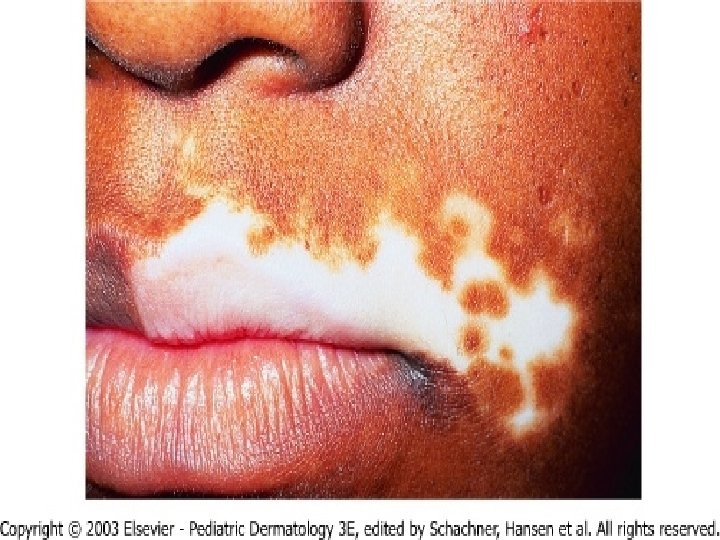 Dermatology Skin hair nails and mucous membranes mouth