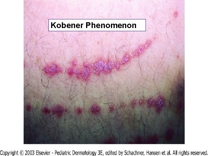 Dermatology Skin hair nails and mucous membranes mouth