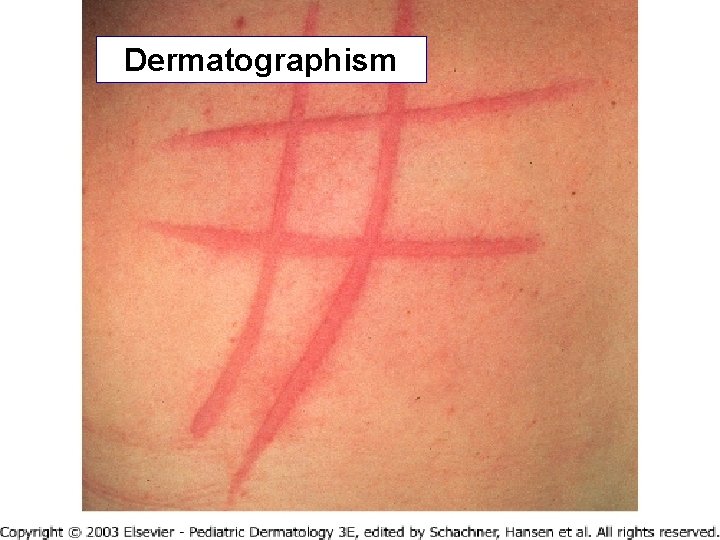 Dermatology Skin hair nails and mucous membranes mouth