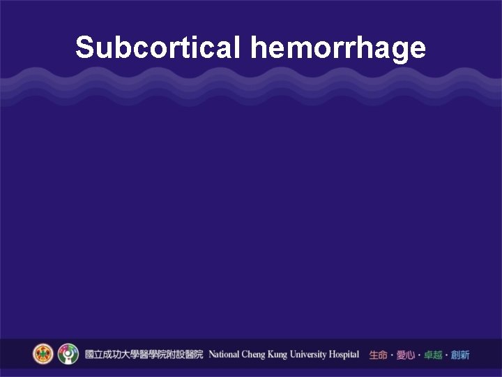 How serious is hemorrhagic stroke in Taiwan About