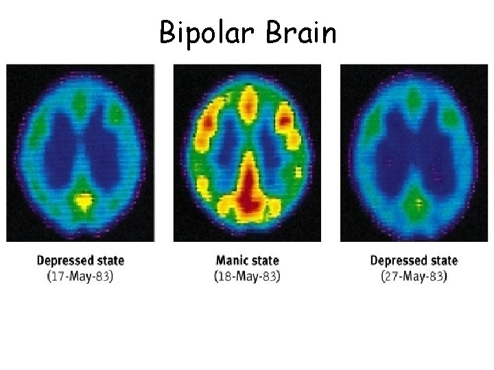 Psychological Disorders Syndrome marked by a clinically significant