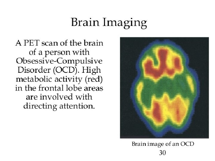Psychological Disorders Syndrome marked by a clinically significant