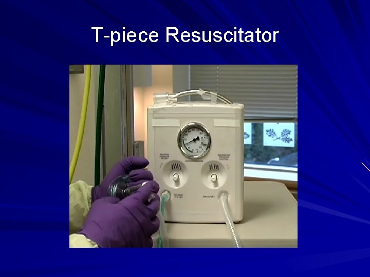 NEONATAL RESUSCITATION The most important and effective action