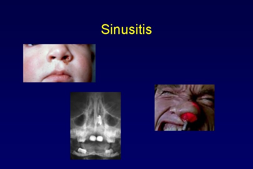 Common ENT Emergencies Arun Badi MD Ph D