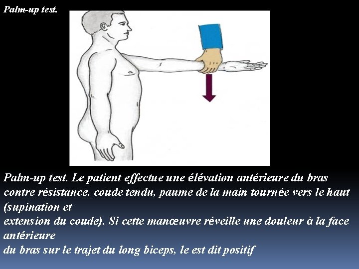 Lpaule douloureuse pathologie de la coiffe des rotateurs
