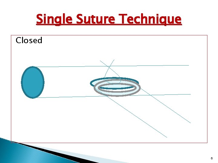 Vascular Anastomosis Workshop Dr Husain jabbad King AbdulAziz