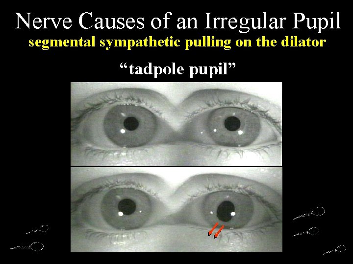 NeuroOphthalmology Division Department of Ophthalmology and Visual Science