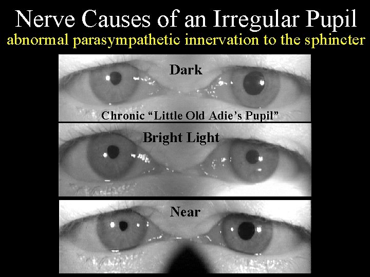 NeuroOphthalmology Division Department of Ophthalmology and Visual Science