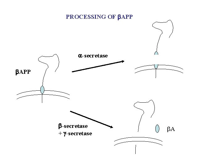 ALZHEIMERS DISEASE AD Senile dementia Characterised by amyloid