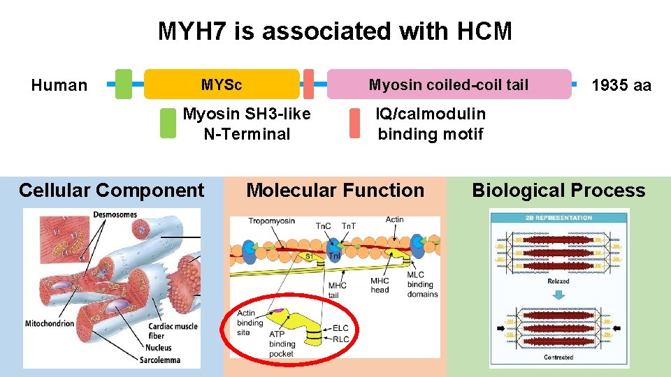 Hypertrophic Cardiomyopathy and MYH 7 Jack Hermsen What