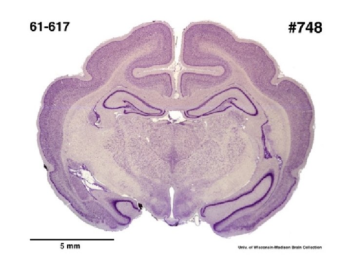 Overview of Neuroscience Tony Bell Helen Wills Neuroscience