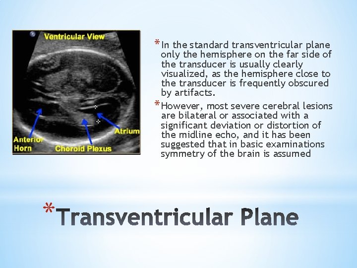 Guideline for evaluation Neural tube defects are the