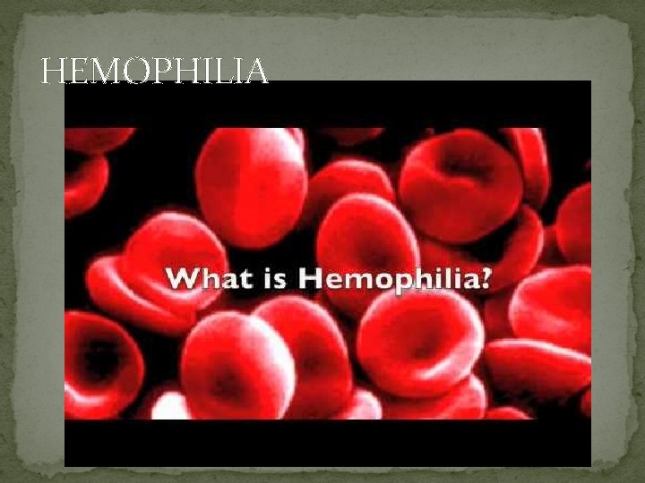 Hemophilia and other bleeding disorders Brought To You
