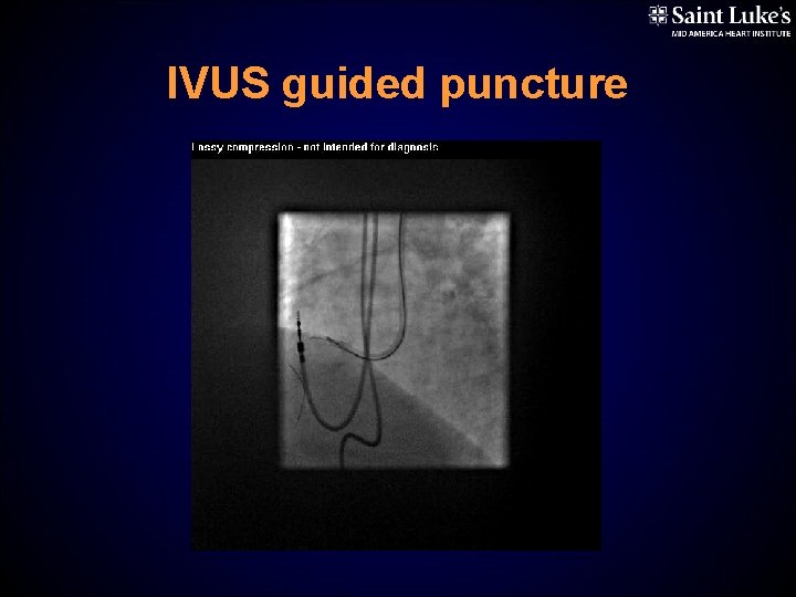 How to get out of a Side Branch