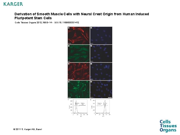 Derivation of Smooth Muscle Cells with Neural Crest