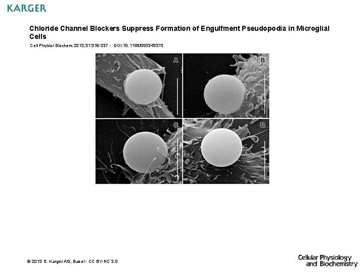 Chloride Channel Blockers Suppress Formation of Engulfment Pseudopodia