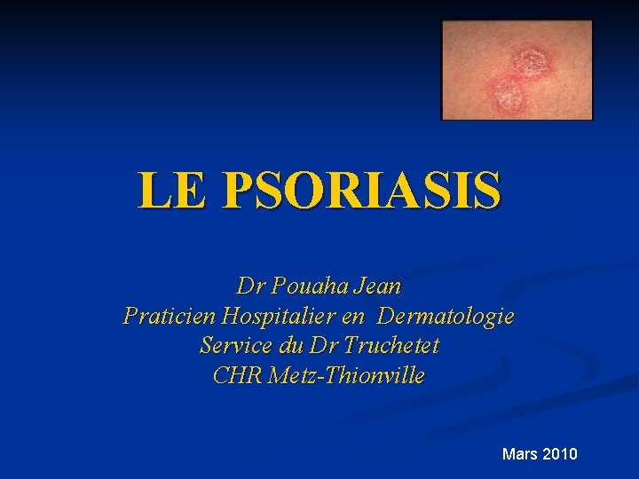 LE PSORIASIS Dr Pouaha Jean Praticien Hospitalier en