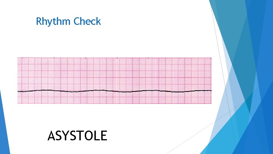 EKG MONITORING OVERVIEW Dr Jennifer Lucy CCMA Prep