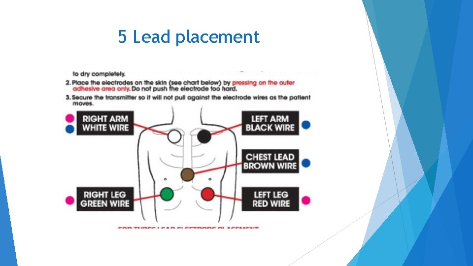 EKG MONITORING OVERVIEW Dr Jennifer Lucy CCMA Prep