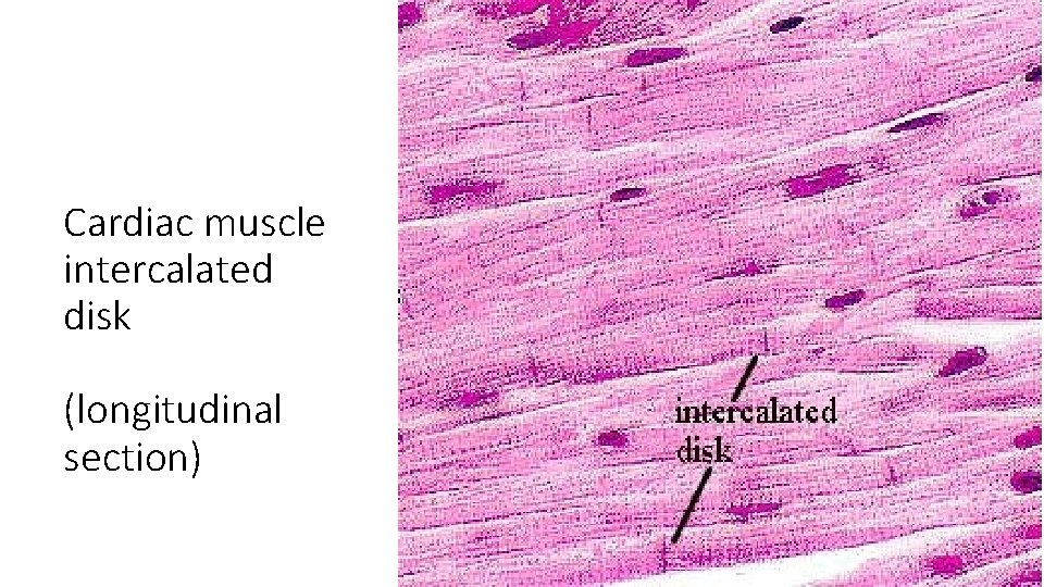 T tubule is an invagination of the muscle
