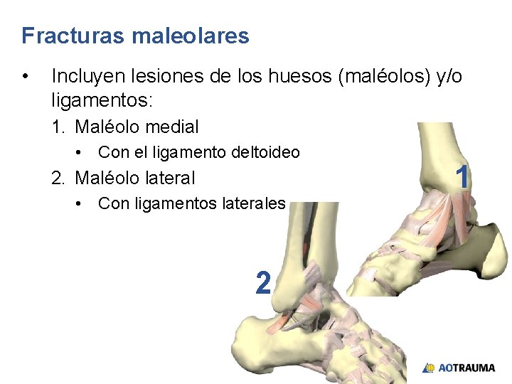 Fracturas maleolares Anna Ekman Lena Brauer Traduccin Elena