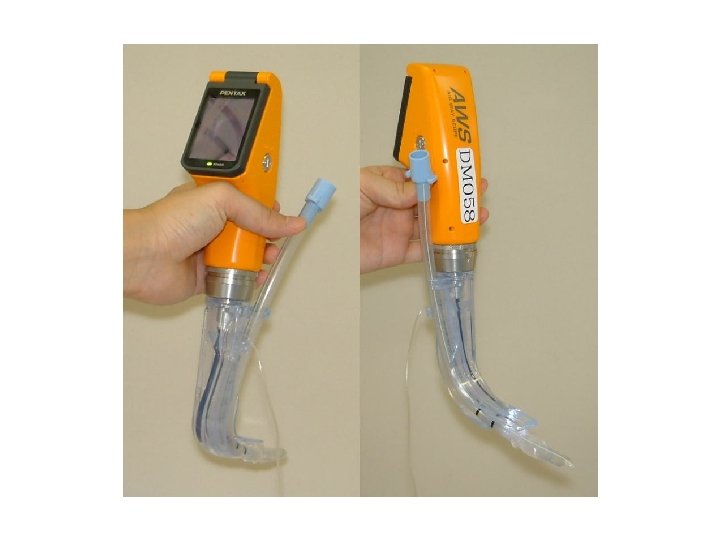 Airway Gadgets Fiberoptic Intubation D John Doyle MD