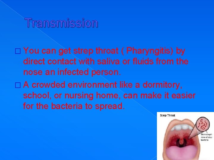 Pharyngitis Made By Jesus Duran Aisha Flores Marivi