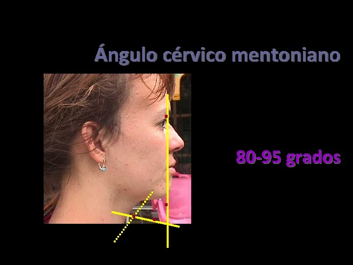 BOCA FORMA Y TIPO DE LABIOS GRANDE REGULAR