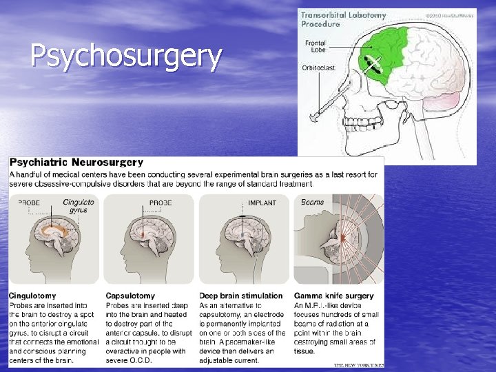 What are your thoughts about this Video Link