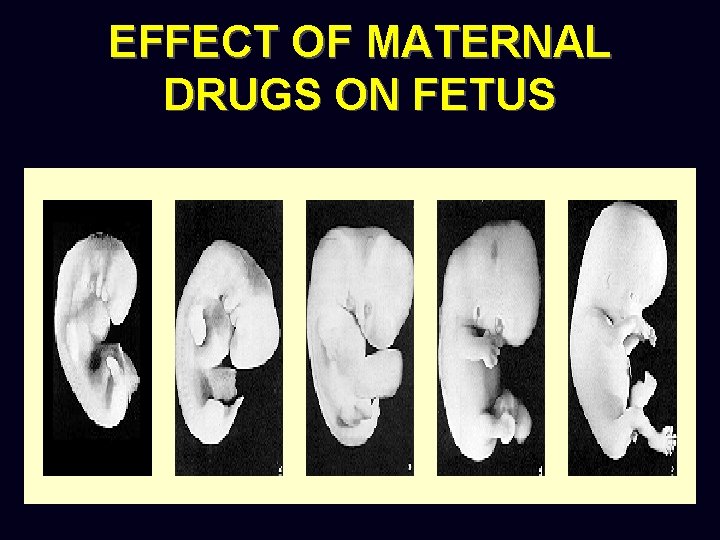 EFFECT OF MATERNAL DRUGS ON FETUS Congenital Malformations