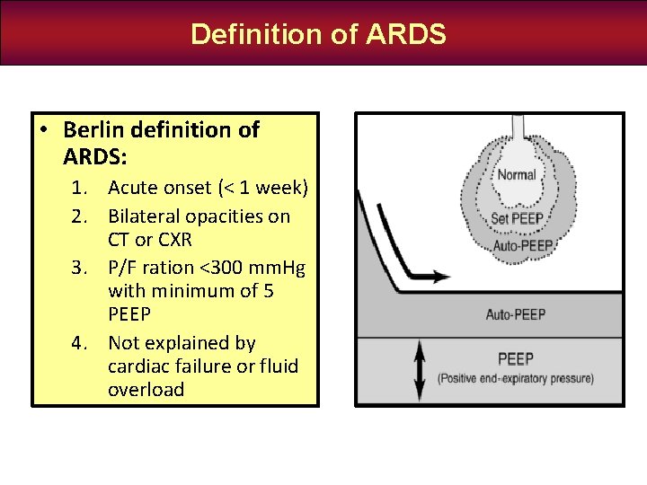 COVID19 Atypical ARDS a New Disease Raj Dasgupta