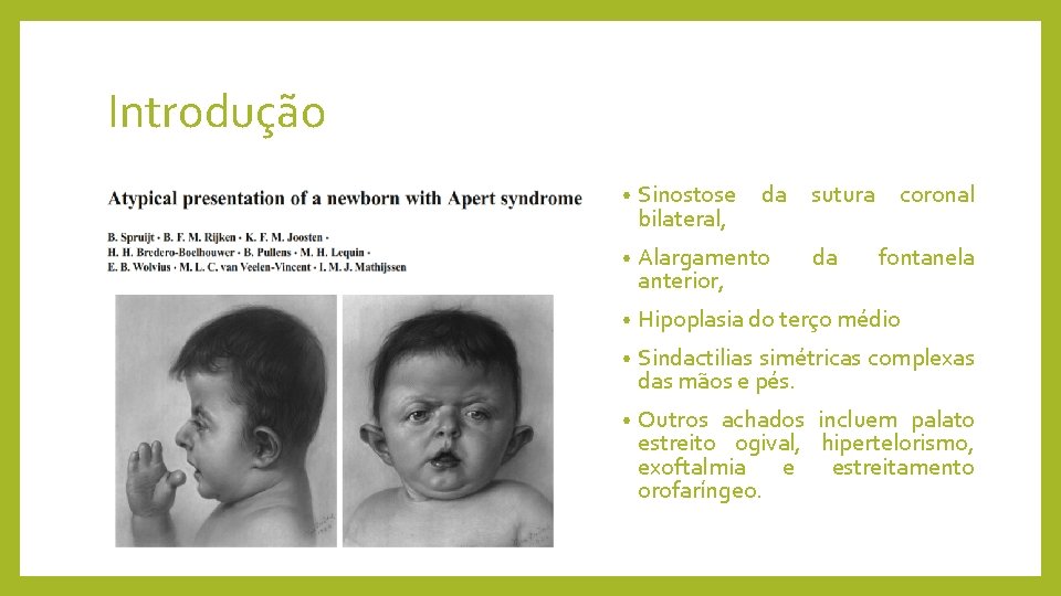 CRANIOSSINOSTOSES SINDRMICAS HABILIDADES NEUROPSICOLINGUSTICAS E ANLISE ...