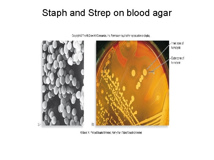 Micro Chapter 18 Microbial diseases of the Skin
