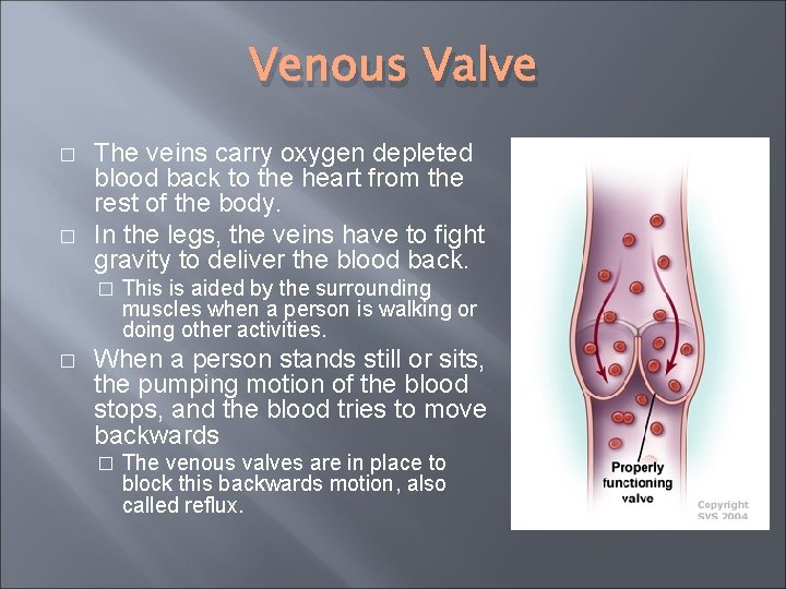 PROSTHETIC VENOUS VALVE By Justin Martin Venous Valve