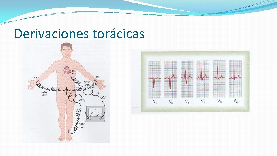 El electrocardiograma normal Anlisis Vectorial del EKG Si