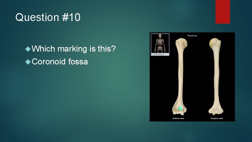 Skeletal System Quiz 3 Review ANATOMY A Question