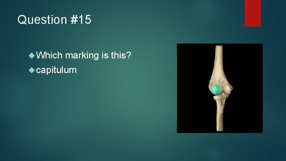 Skeletal System Quiz 3 Review ANATOMY A Question