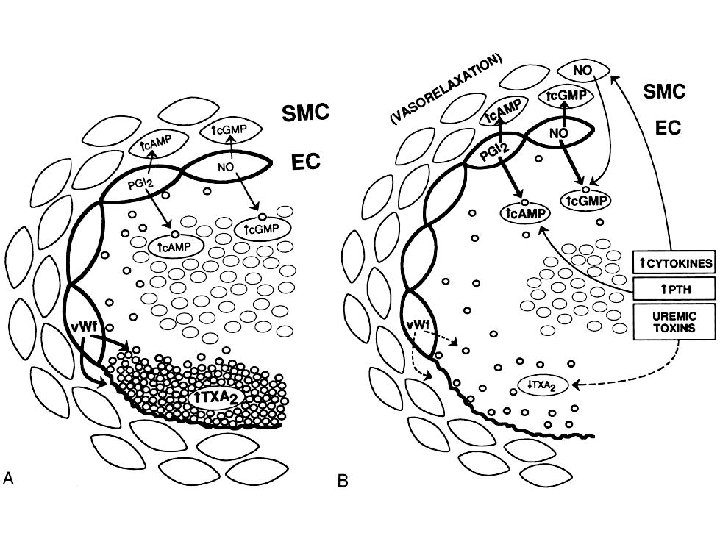 Good Morning 6 June 2003 Uremic Bleeding Pathogenesis