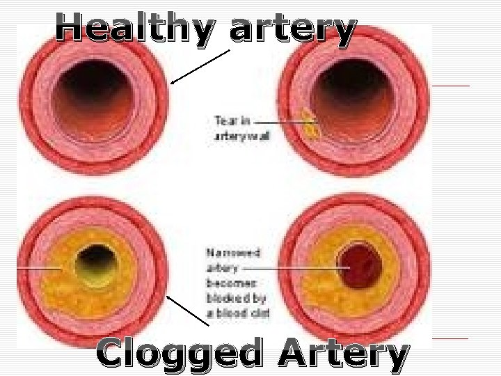 Heart Disease Heart Disease Your Heartbeat Minute Hour