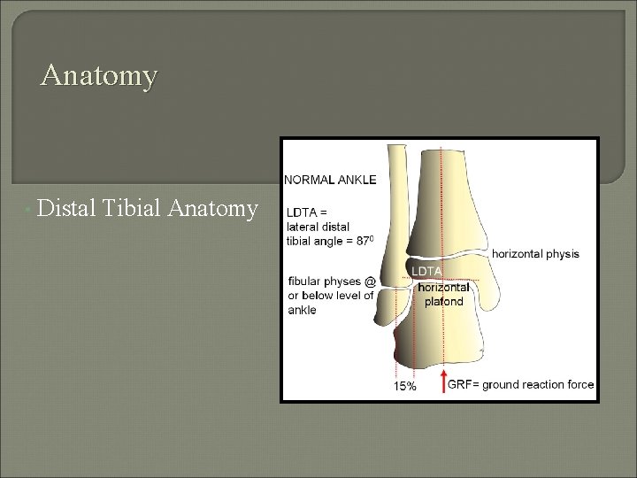 Ankle Arthroplasty Can the Ankle Joint be Replaced