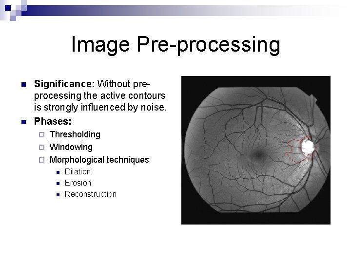 Active Contours Technique in Retinal Image Identification of